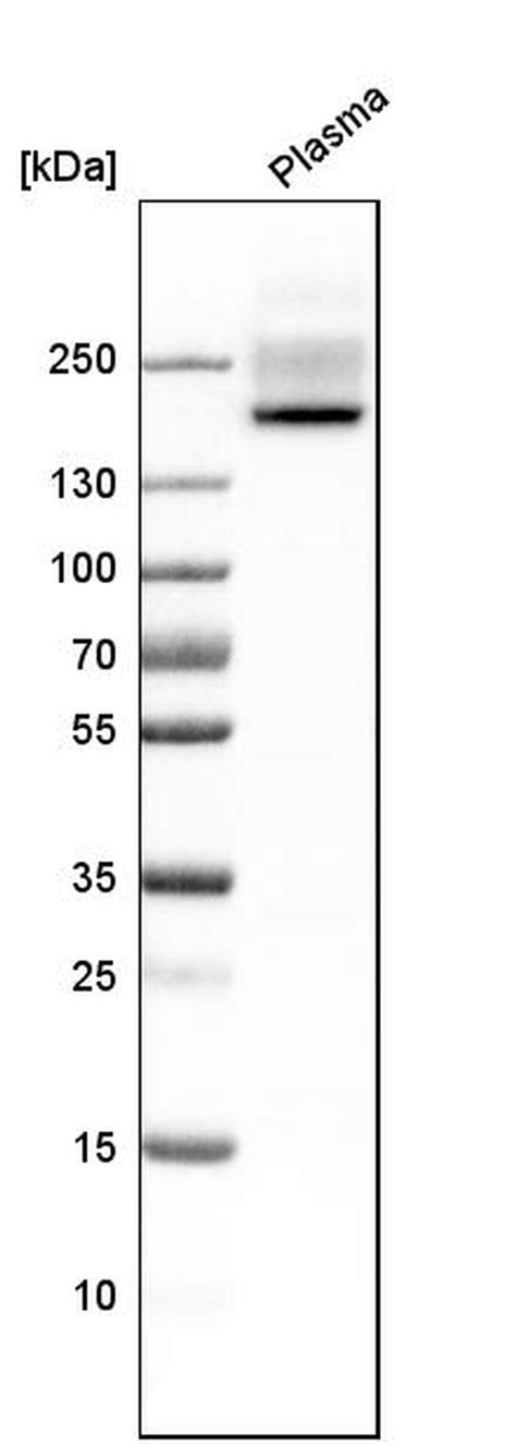 Complement Factor H Polyclonal Antibody Pa5 83957