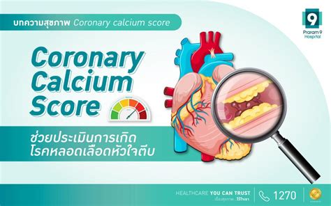 Coronary calcium score ชวยประเมนการเกดโรคหลอดเลอดหวใจตบ Praram 9 Hospital