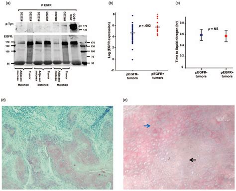 Protein analysis by IPW and IHC. (a) Representative EGFR IPW analysis ...