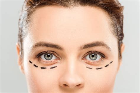 Lower Blepharoplasty Operation