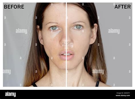 The Face Of A Young Girl Is Divided Into Two Halves With And Without Face Retouching With Seven