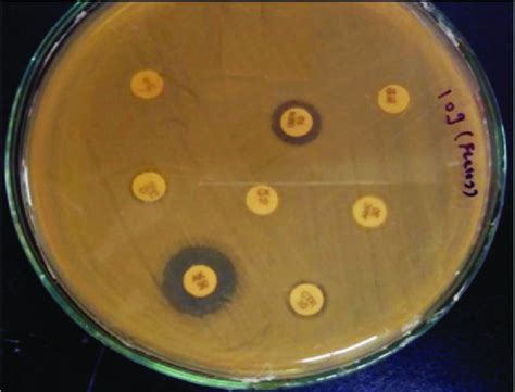 In Vitro Antimicrobial Drug Sensitivity Test For Esbls Producing E