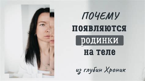 Почему появляются родинки на теле Из глубин Хроник Youtube