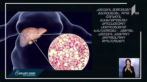 ღვიძლის გაცხიმოვნება და მასთან ასოცირებული გენები კვლევა Youtube