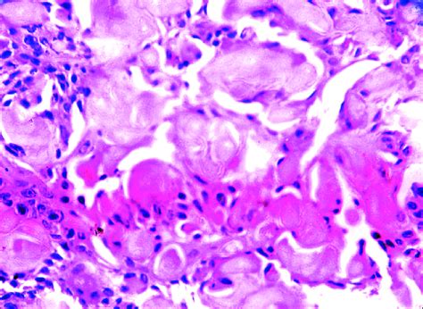 Ghost Cell H And E ×40 Download Scientific Diagram