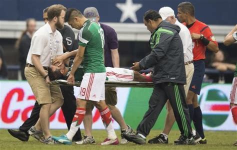 No Apto Para Impresionables Un Jugador De México Se Fracturó La Tibia