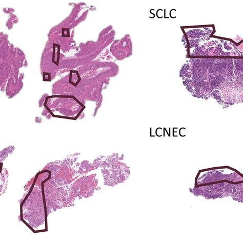 Top K Patches In Wsi Top 50 Patches Are Annotated Download Scientific Diagram