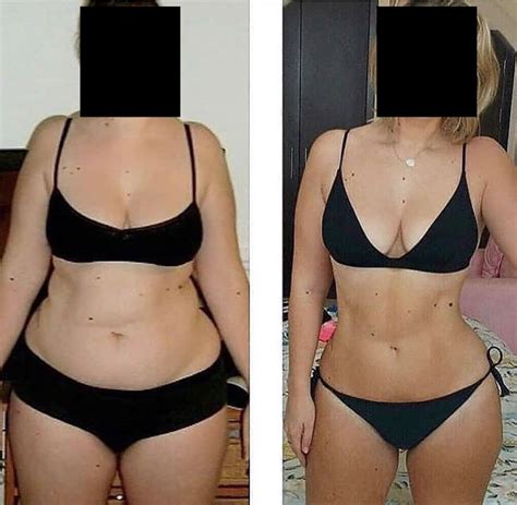 Dieta Cetogênica Vale A Pena Fazer Cirurgião Vascular Dr Daniel
