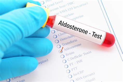 Aldosterone La Sua Funzione Ed I Rischi Di Un Valore Alto