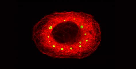 Membraneless Organelles Interact With The Cytoskeleton Inside The Cell Department Of Materials