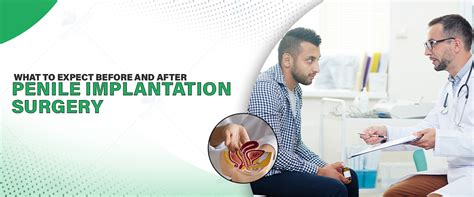 Penile Implantation Surgery What To Expect Before And After