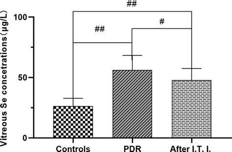 Comparisons In Vitreous Se Concentration Between Pdr Patients Without Download Scientific