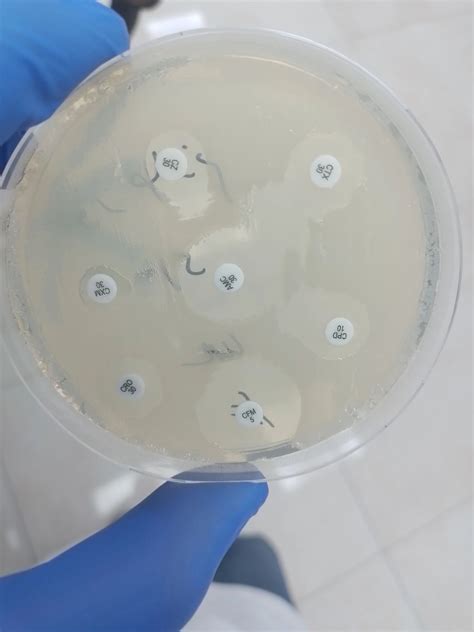 Mohammad Younis On Linkedin Can You Gusse What Happens Here To Make This Li Esbl What