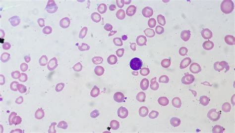 Кръвни изследвания Кръвен тест Vivata Bg