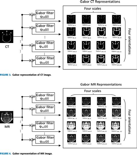 Figure 1 From Multimodal Medical Image Fusion Based On Gabor Representation Combination Of Multi