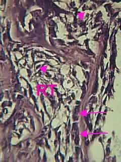 Magnifying View For Figure 12 Shows Reticular Tissue RT With Download Scientific Diagram