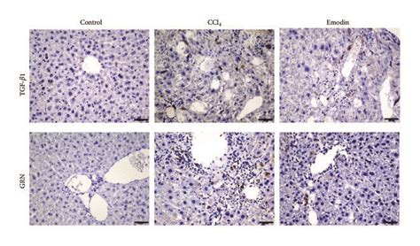 Emodin Inhibited The Gr 1 Hi Monocyte Associated Profibrogenic