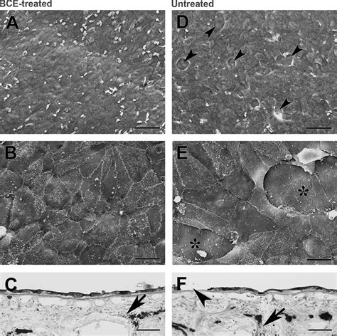 Morphology Of Fetal Rpe Resurfacing Of Submacular Bruchs Membrane From Download Scientific