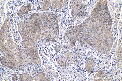 Ihceasy Lc3 Ready To Use Ihc Kit Khc0940 Proteintech 武汉三鹰生物技术有限公司