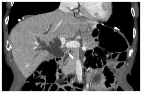 Image Acquired From Multi Detector Row Computed Tomography Revealing Download Scientific