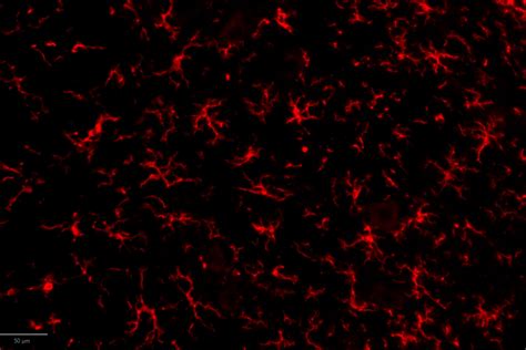 Launch Of The Northern Ireland Multiple Sclerosis Research Hub Multiple Sclerosis Research Ni