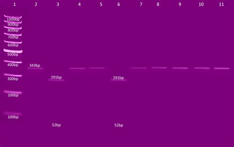 Restriction Fragment Length Polymorphism Rflp Polymerase Chain