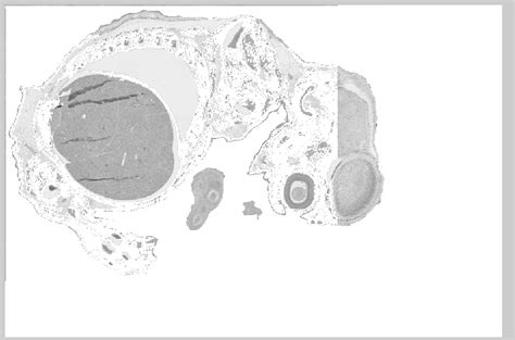 求助各位大神~关于图像分割的区域生长算法的问题 Csdn社区