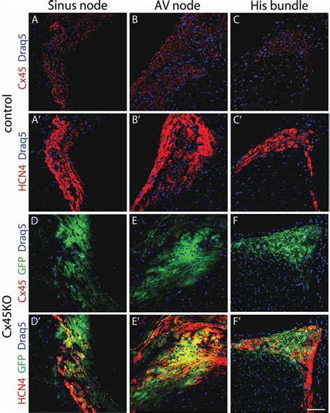 Connexin45 Provides Optimal Atrioventricular Nodal Conduction In The Adult Mouse Heart