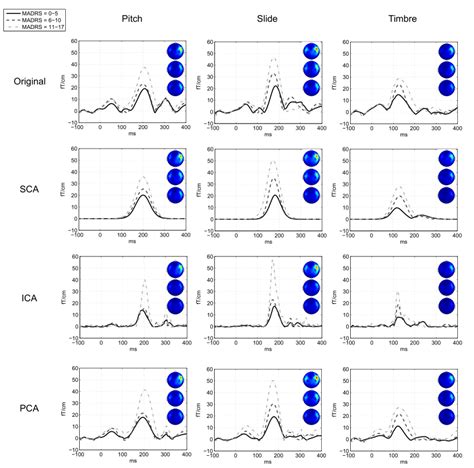 Average Meg Gradiometer Waveforms And Topographies Of Single Subject Download Scientific