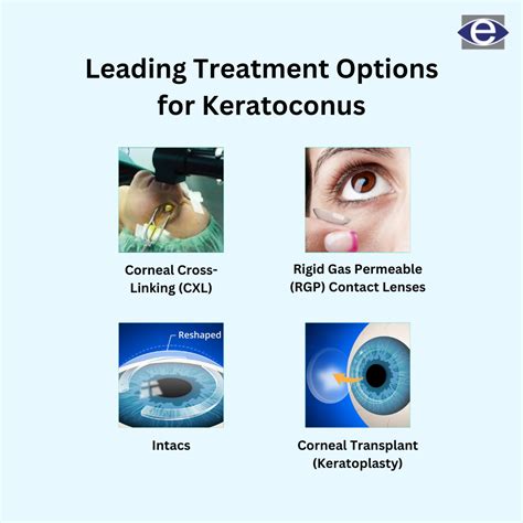 How Keratoconus Treatment Can Restore Your Eye Health