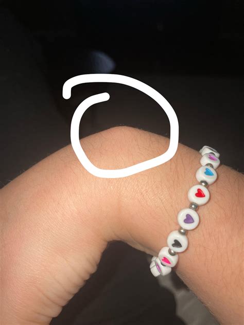 Got A Strange Bump On My Scrotum I Dont Have Sex And Theres No Symptoms Though It Did Feel