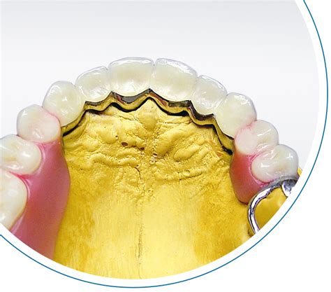 Combined Prosthetic Restorations
