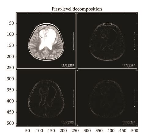 Schematic Of Brain Mri Image By 1 Level Discrete Wavelet Decomposition