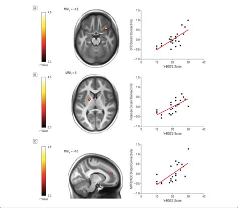 Positive Correlation Between Overall Obsessive Compulsive Disorder Download Scientific Diagram