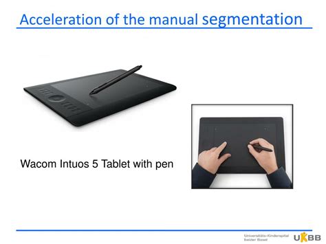 Ppt Spine Segmentation In The Surgical Scoliosis Treatment Powerpoint Presentation Id1867325