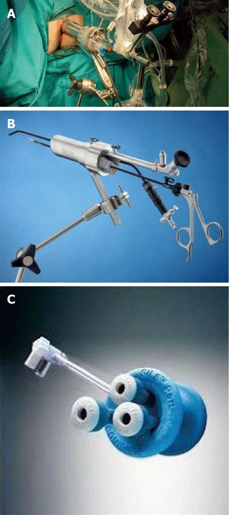 Transanal Endoscopic Microsurgery A Transanal Endoscopic Operation
