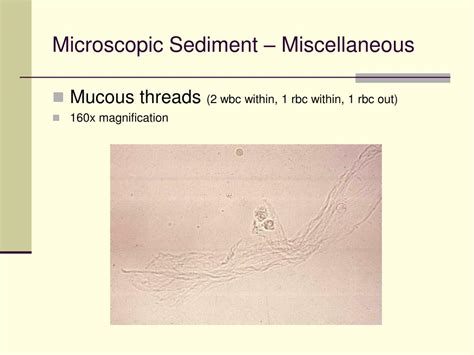 Ppt Microscopic Sediment Miscellaneous Powerpoint Presentation