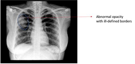 Visualizing Deep Learning Networks Part Ii