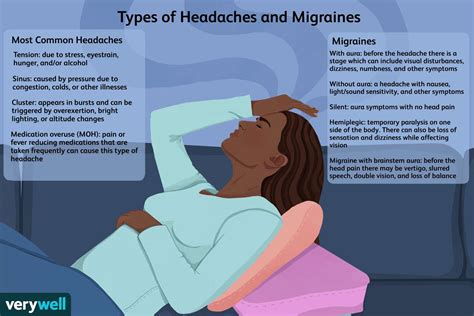 Migraine Symptoms Vision
