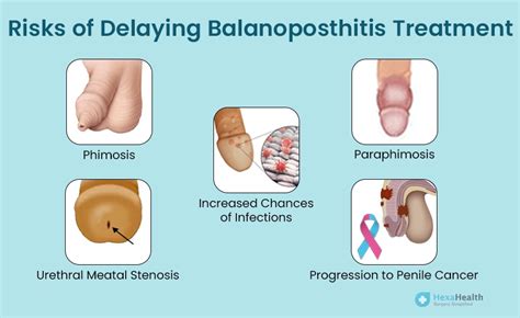 Balanoposthitis Symptoms Test Surgery And Prevention