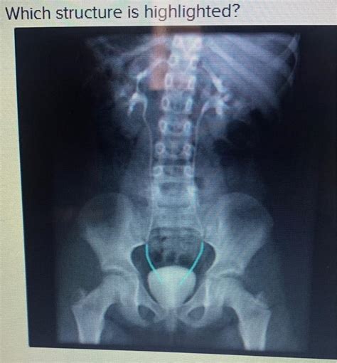Solved Which Structure Is Highlighted Segobee O Cortex