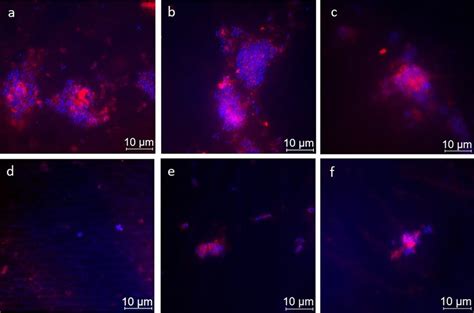 Representative Fluorescence Microscopic Images Showing Combined Dapi