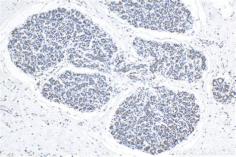 Histone H3 Antibody 17168 1 Ap Proteintech 武汉三鹰生物技术有限公司