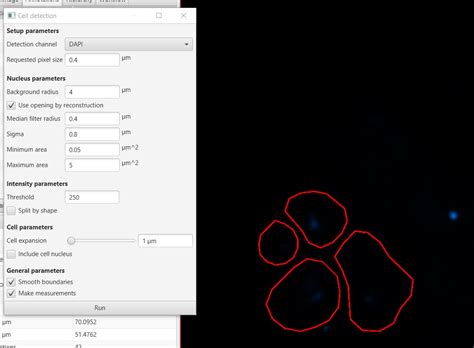 Cell Detection Issues In Qupath Image Analysis Image Sc Forum