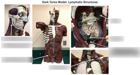 Lymphatic Structures Diagram Quizlet