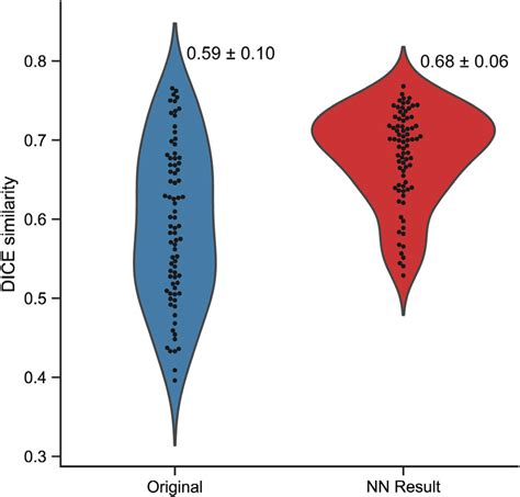 Comparison Of Segmentations Generated Using The Phase Contrast Magnetic Download Scientific