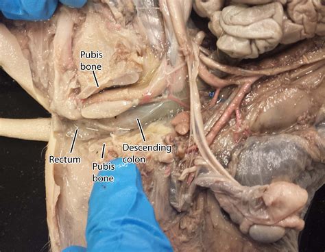Human Female Dissection