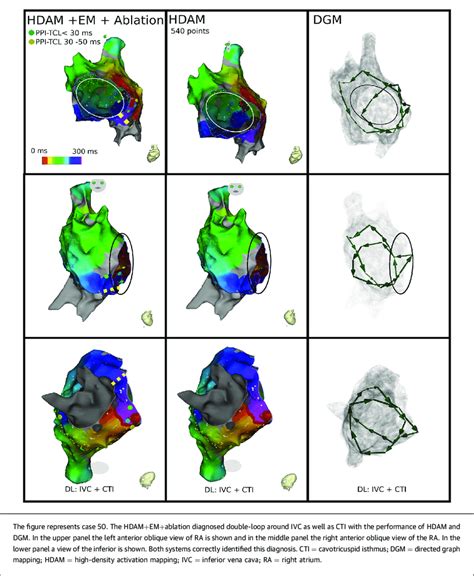 A Case Of A Double Loop Download Scientific Diagram