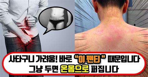 사타구니가 가렵다면 절대 이 팬티 입지 마세요 사타구니 가려움 해결 방법