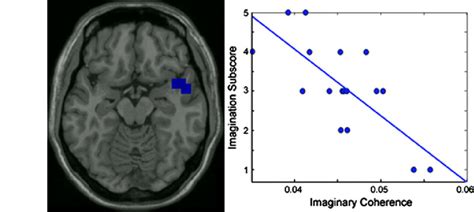 Results Of A Correlation Analysis Between Resting State Meg Functional